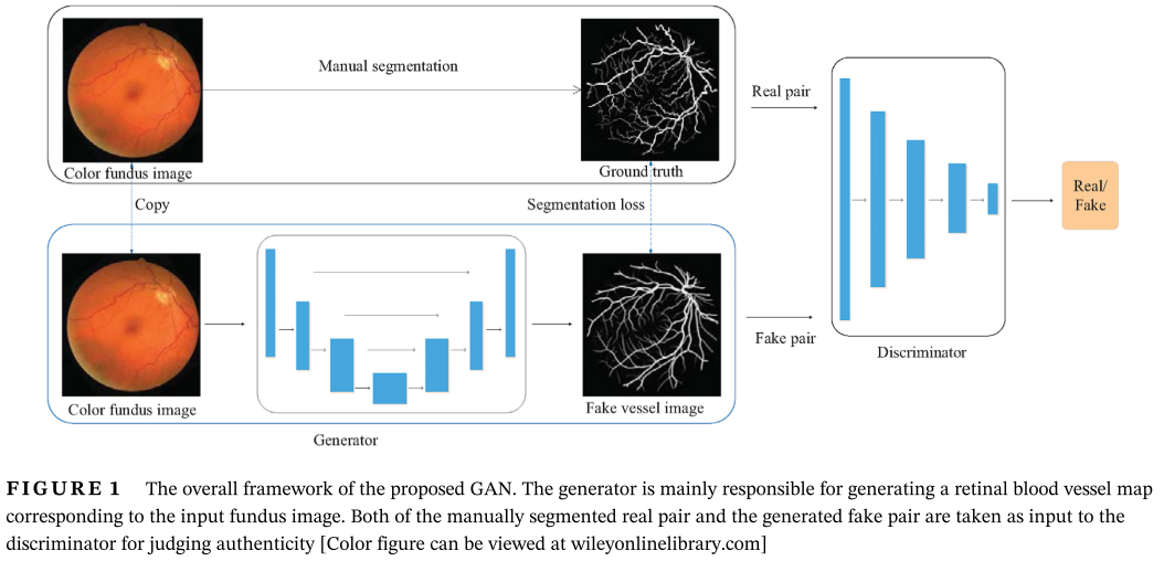 High‐quality retinal vessel segmentation using generative adversarial ... High‐quality retinal vessel segmentation using generative adversarial ...
